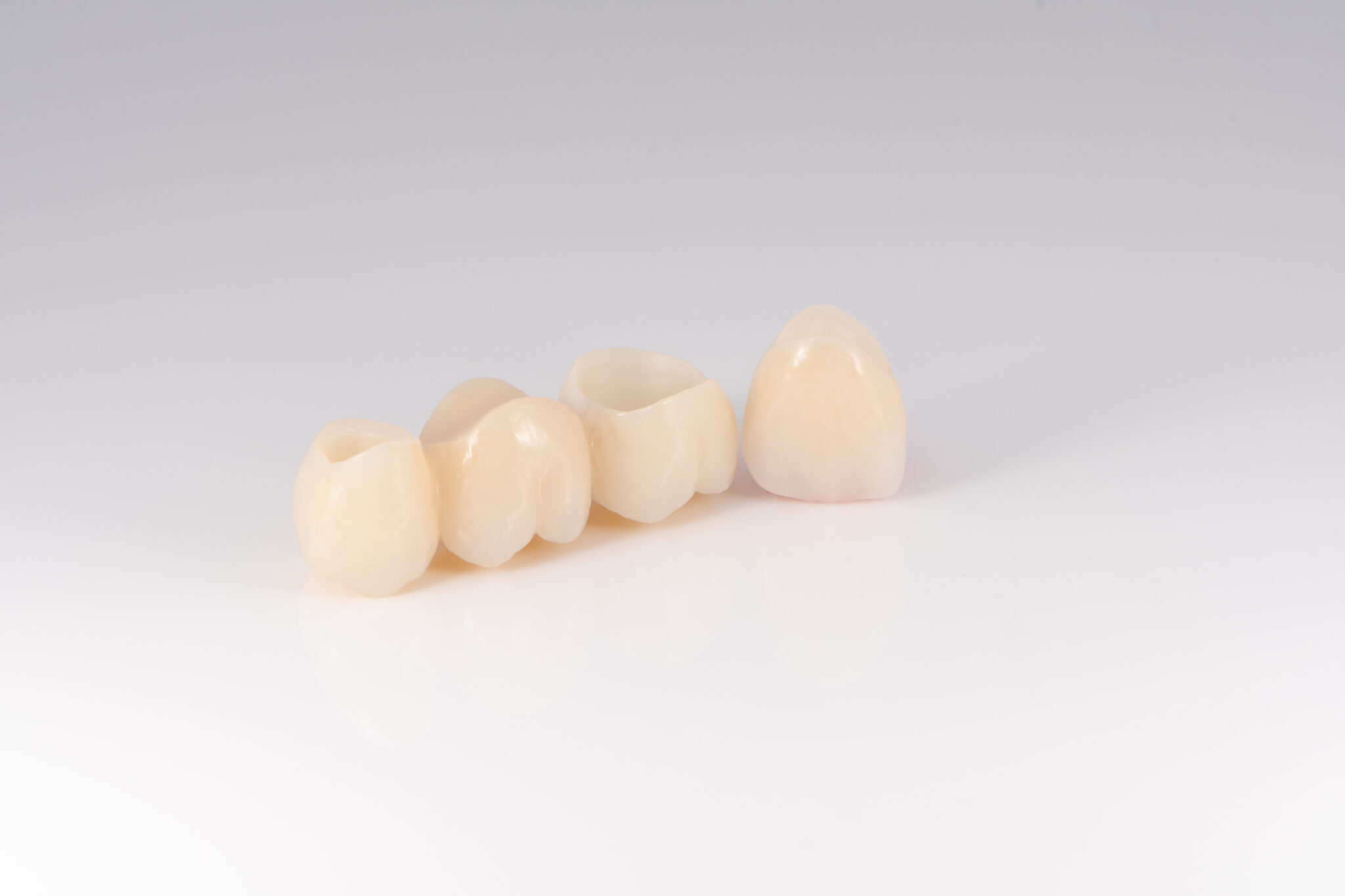 Post-Cementation Sensitivity Checklist for Crowns - Associated Dental Lab