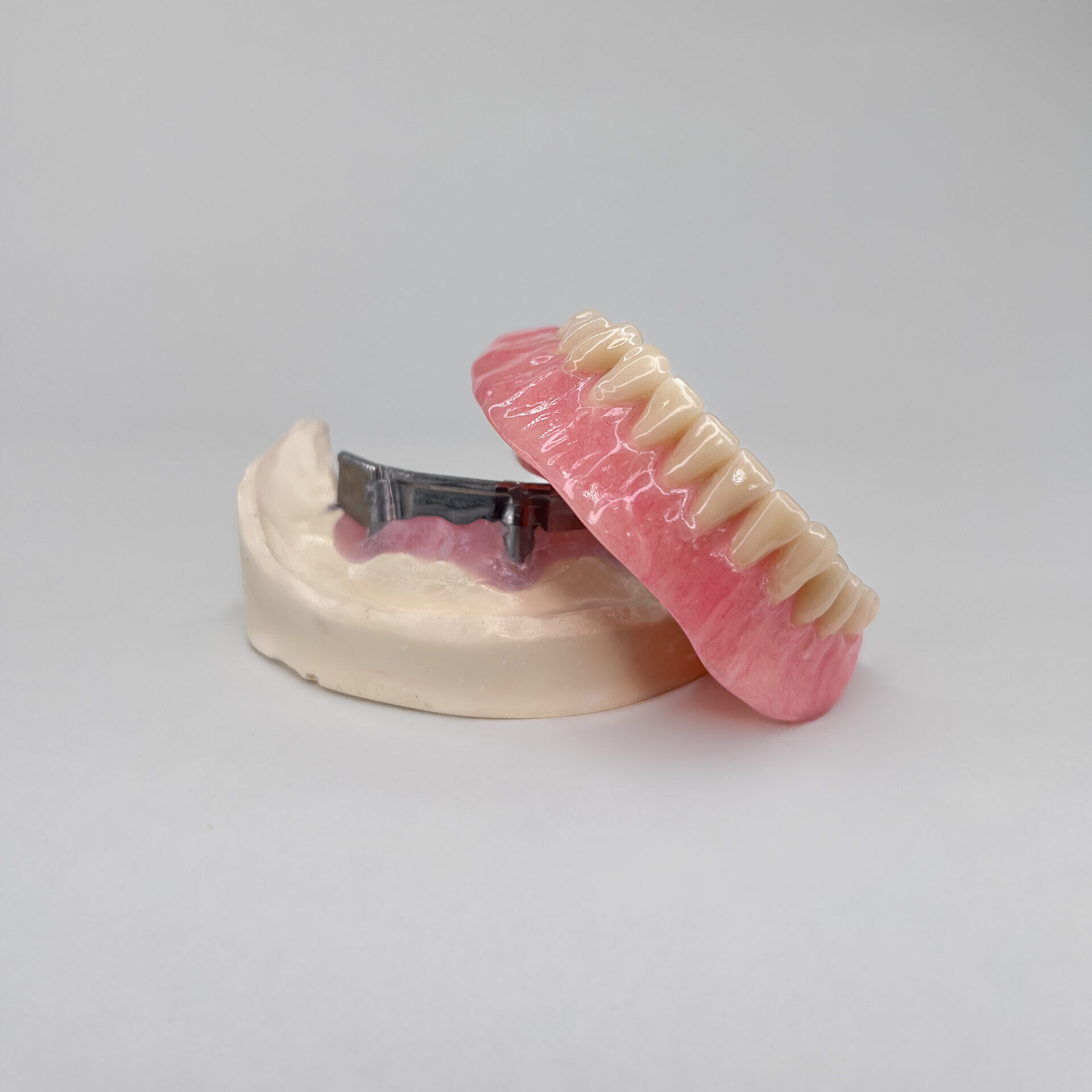 Titanium/Acrylic Hybrid Implant | Strong, Repairable, Natural ...