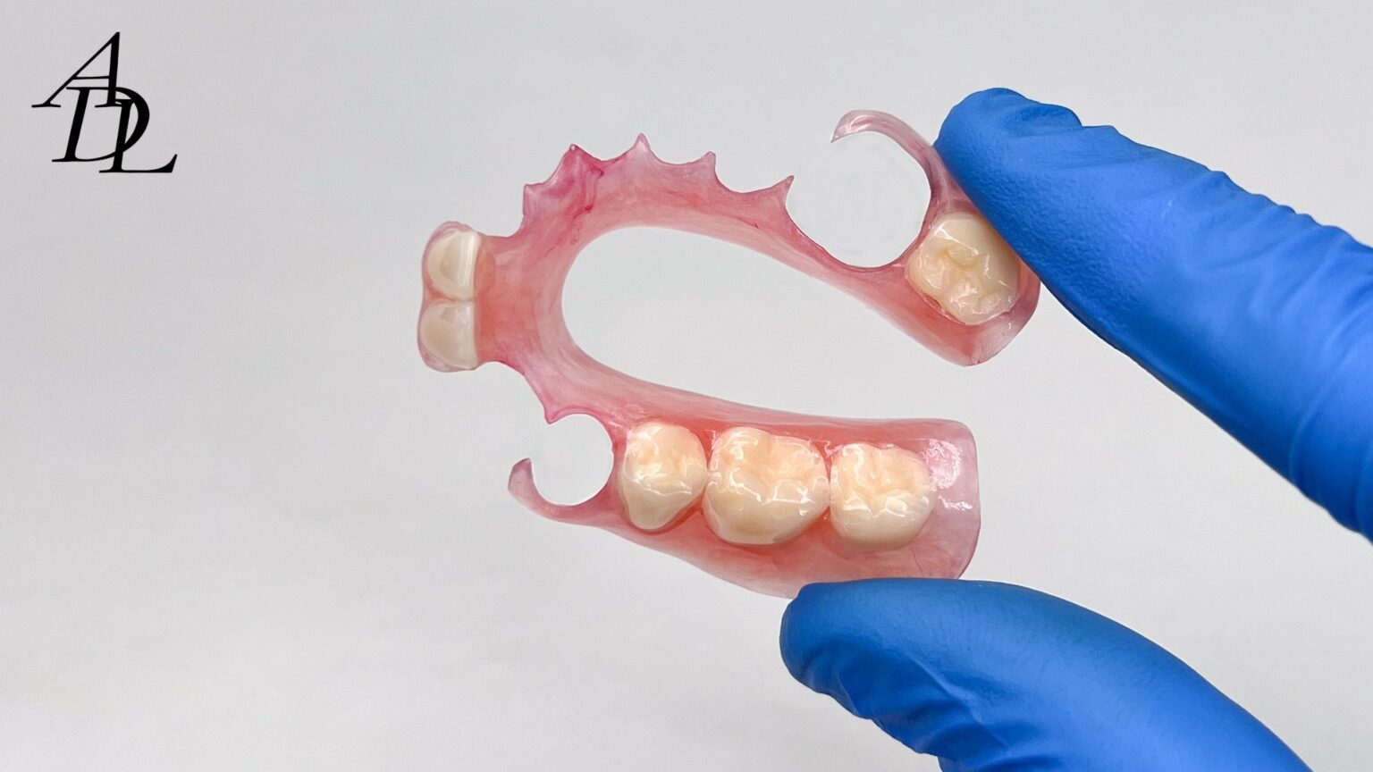 Flexible Partials That Last: Design & Finish Tips - Associated Dental Lab
