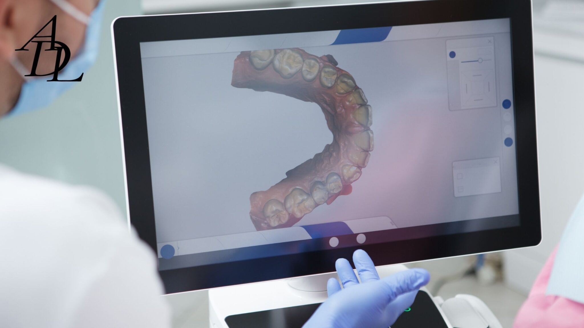 Spot & Prevent Intraoral Scan Stitching Errors - Associated Dental Lab