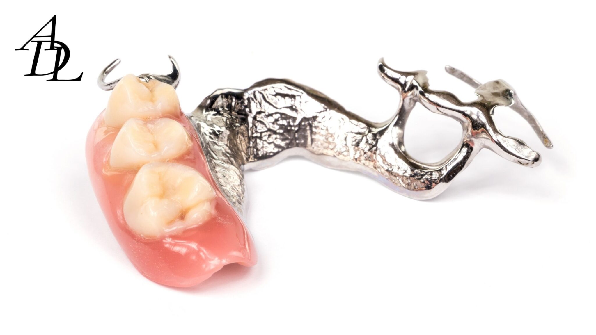 RPD Framework Try-In Checklist for Partial Dentures - Associated Dental Lab